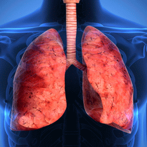 Cystic Fibrosis Lungs Vs Normal Lungs
