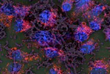 Single Strep Protein Sets Off White Blood Cell Early Warning System