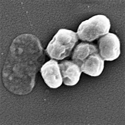 Xerava Shows Promise For Treating CRAB