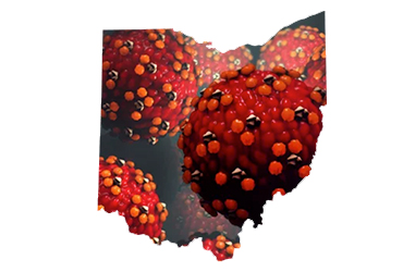 81 Cases of Measles in Central Ohio