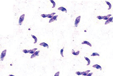 Toxoplasmosis Surveillance Infection