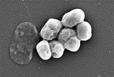 Xerava Shows Promise For Treating CRAB