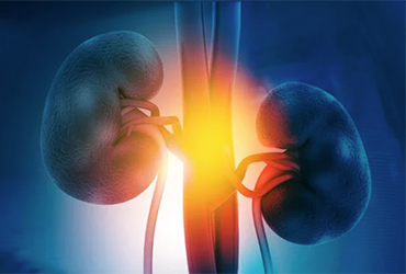 FDA Clears VIDAS NephroCheck for Detection of Kidney Stress in AKI Patients
