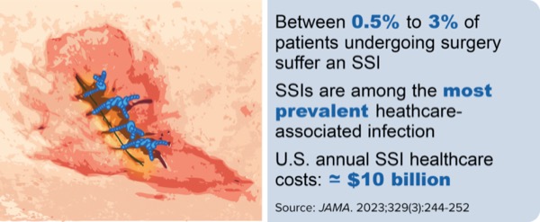 Updated Strategies Provide New Tactics for SSI Prevention
