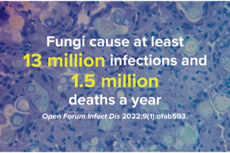 Threat of Fungal Infections And Need for New Drugs Are Still Acute