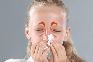Antibiotics Children Pediatrics Sinuses Sinus Sinus Infection
