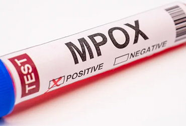 FDA Authorizes Xpert Mpox Test for Emergency Use