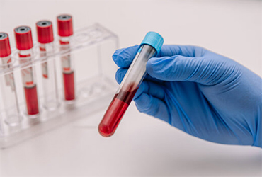 TriVerity Test Inflammatix Higher Accuracy