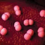 IntelliSep rapid sepsis diagnostic test