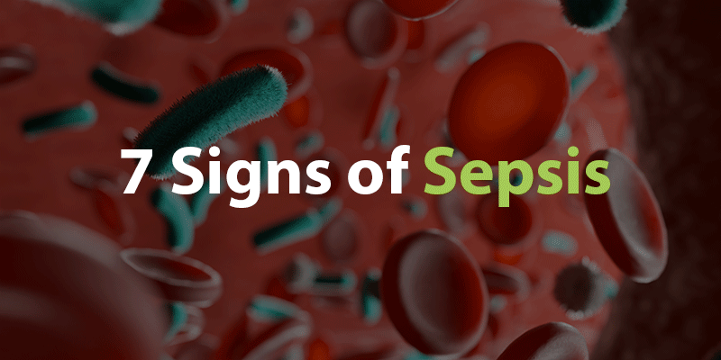 Are Sepsis Rapid Response Teams Worth the Challenge?