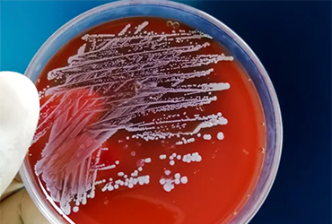 Rapid Blood Culture Identification MSSA