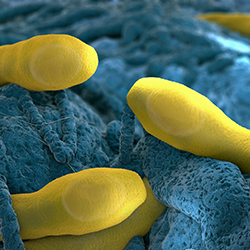 nonresponding pneumonia advice tips